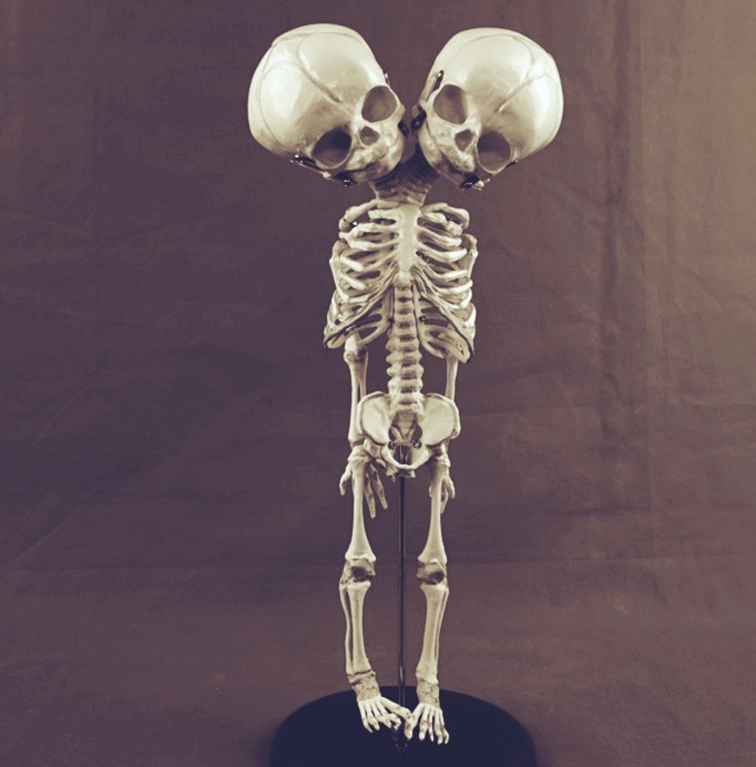 Double-headed Anatomy Skeletal Model Fetus, Skeleton, Skull, Bizarre ...