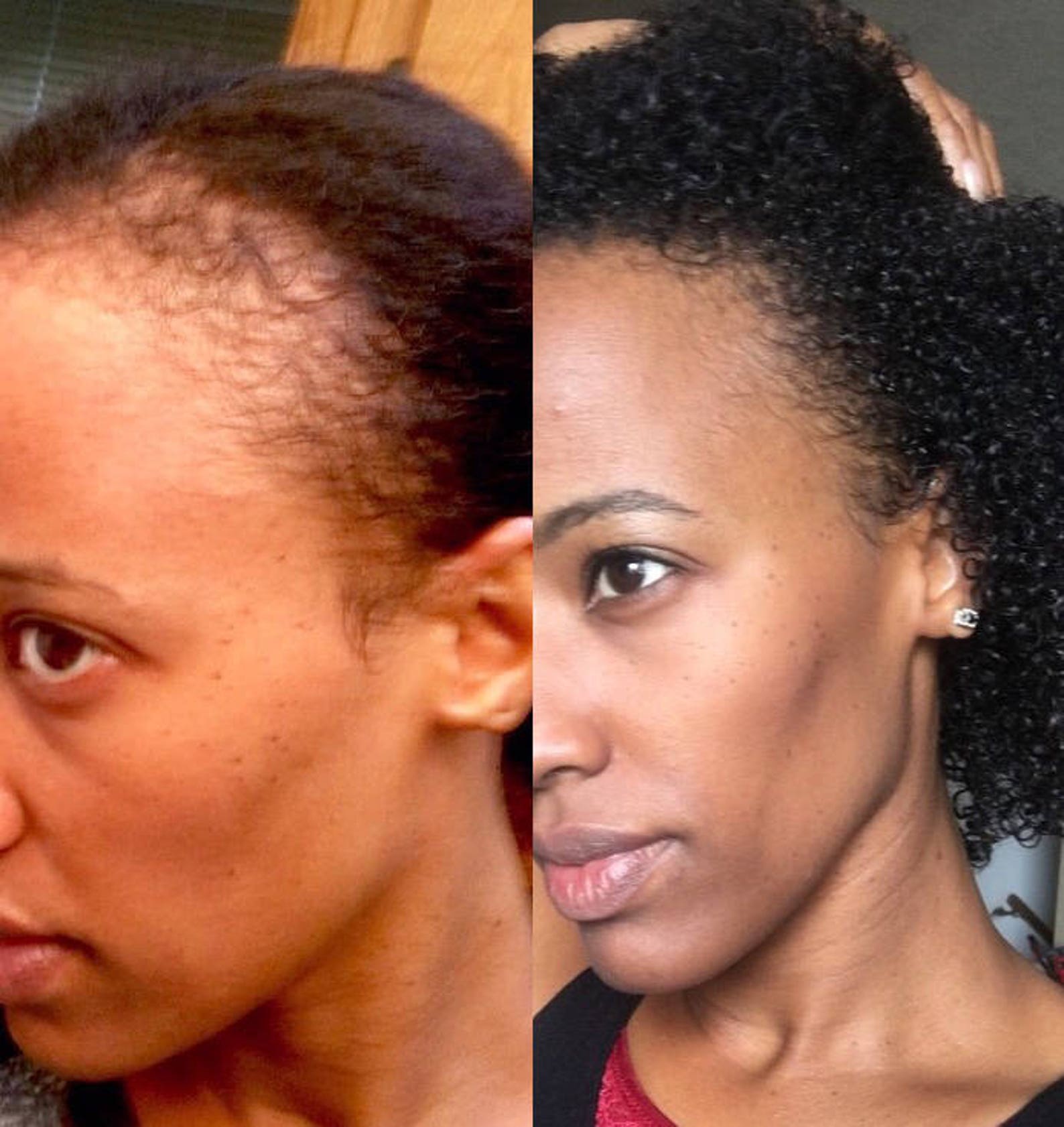Herbal Scalp Care Grease & Balm, Petroleum Free Growth Treatment for ...