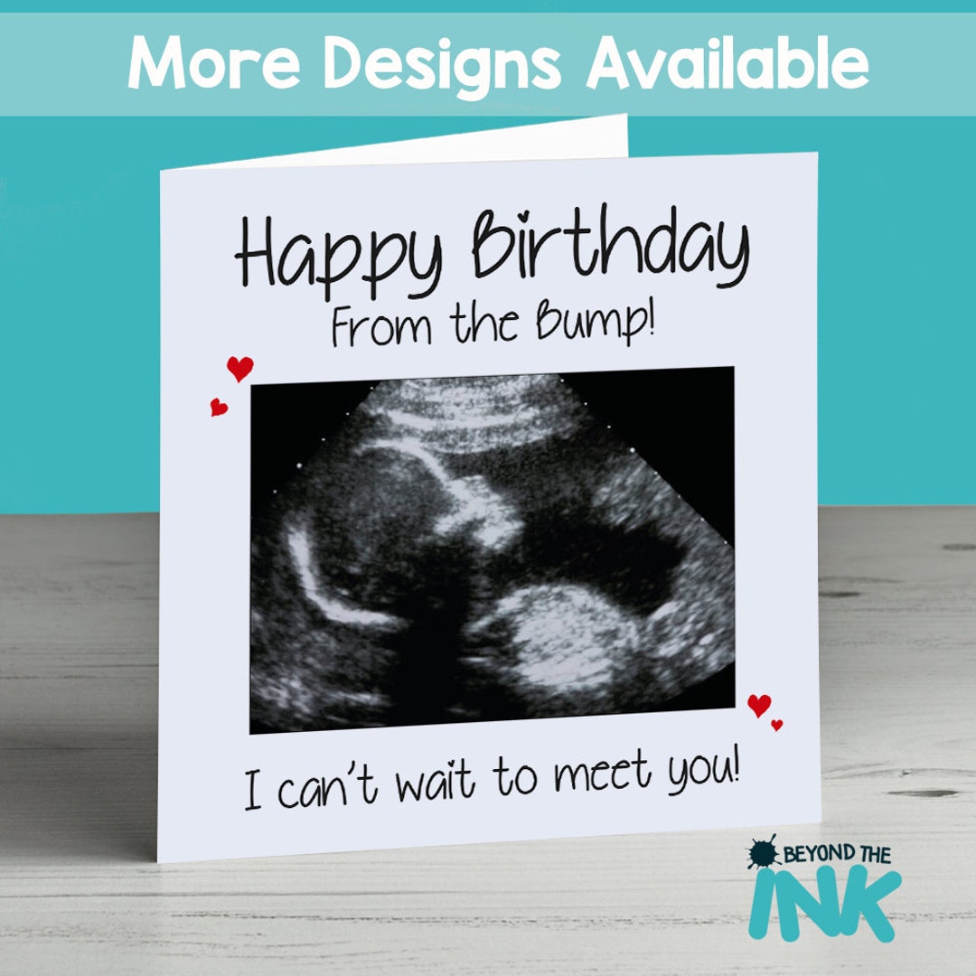 Personalised Baby Scan Birthday Card Card From the Bump - Etsy