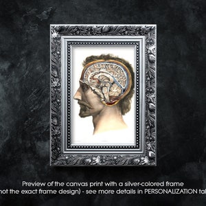 Brain Anatomy by Nicolas Henri Jacob Art Print • Gift for Goths ...
