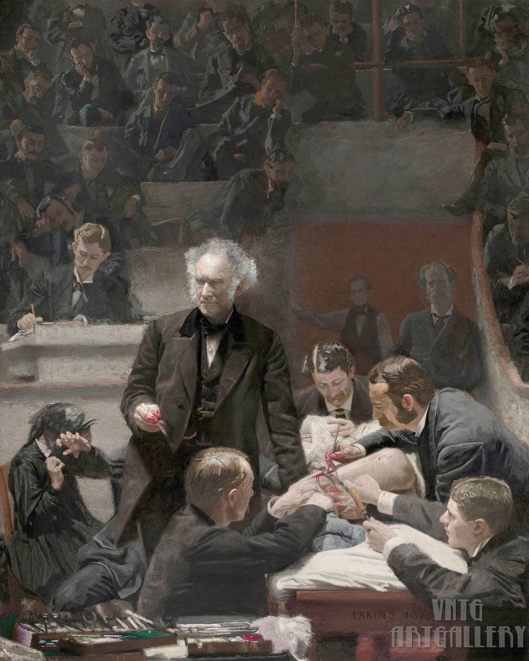 Thomas Eakins : the Gross Clinic (1875) Canvas Gallery Wrapped or ...