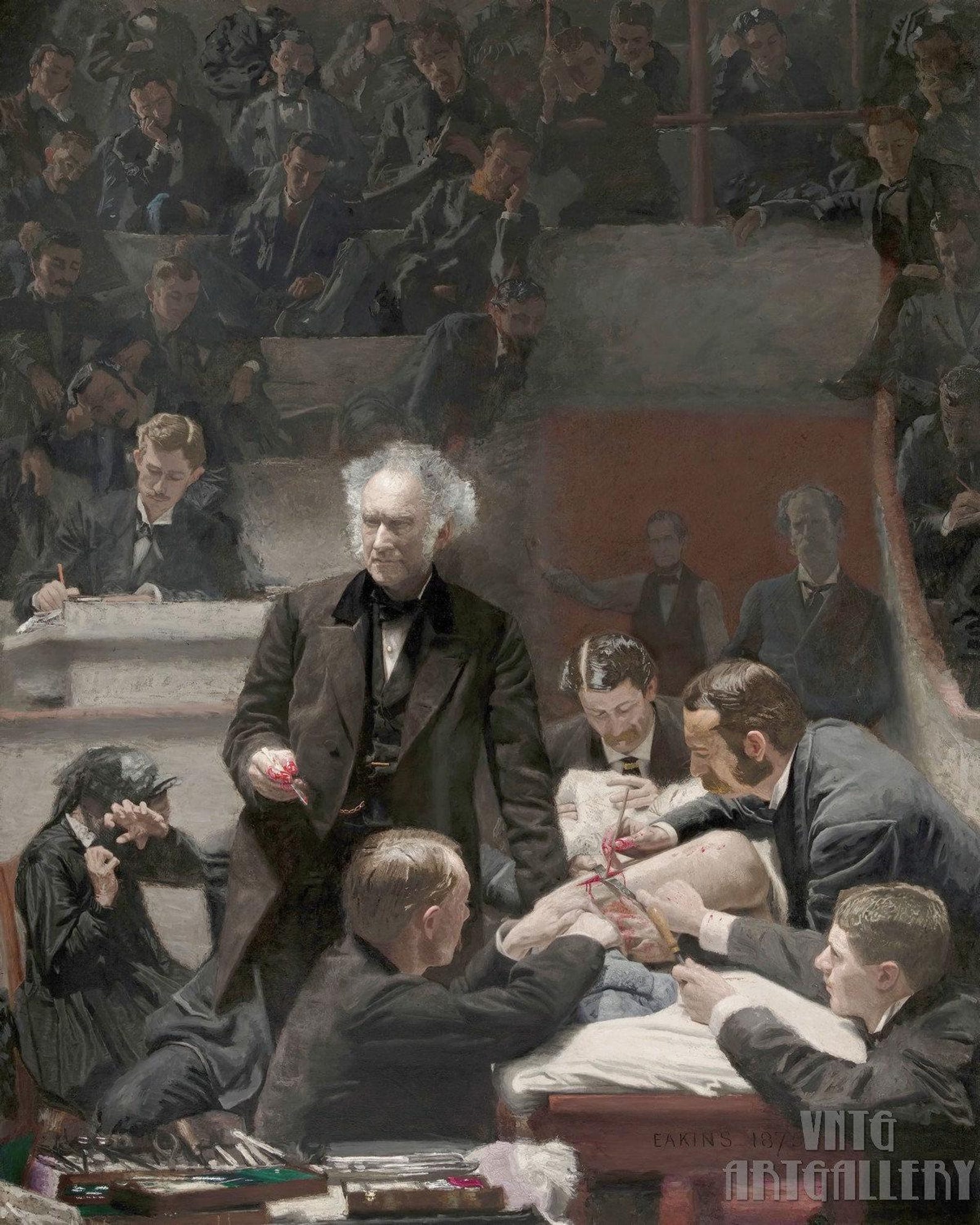 Thomas Eakins : the Gross Clinic (1875) Canvas Gallery Wrapped or ...