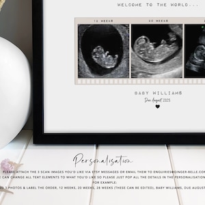 Personalized Baby Scan Photo Print: Mum-to-be Gift, Custom Baby ...