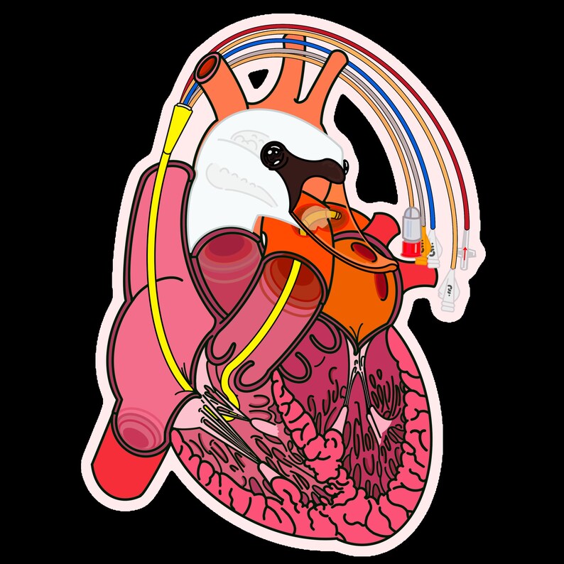 Swan Heart Medical Sticker - Unique Design With Swan-ganz Catheter ...