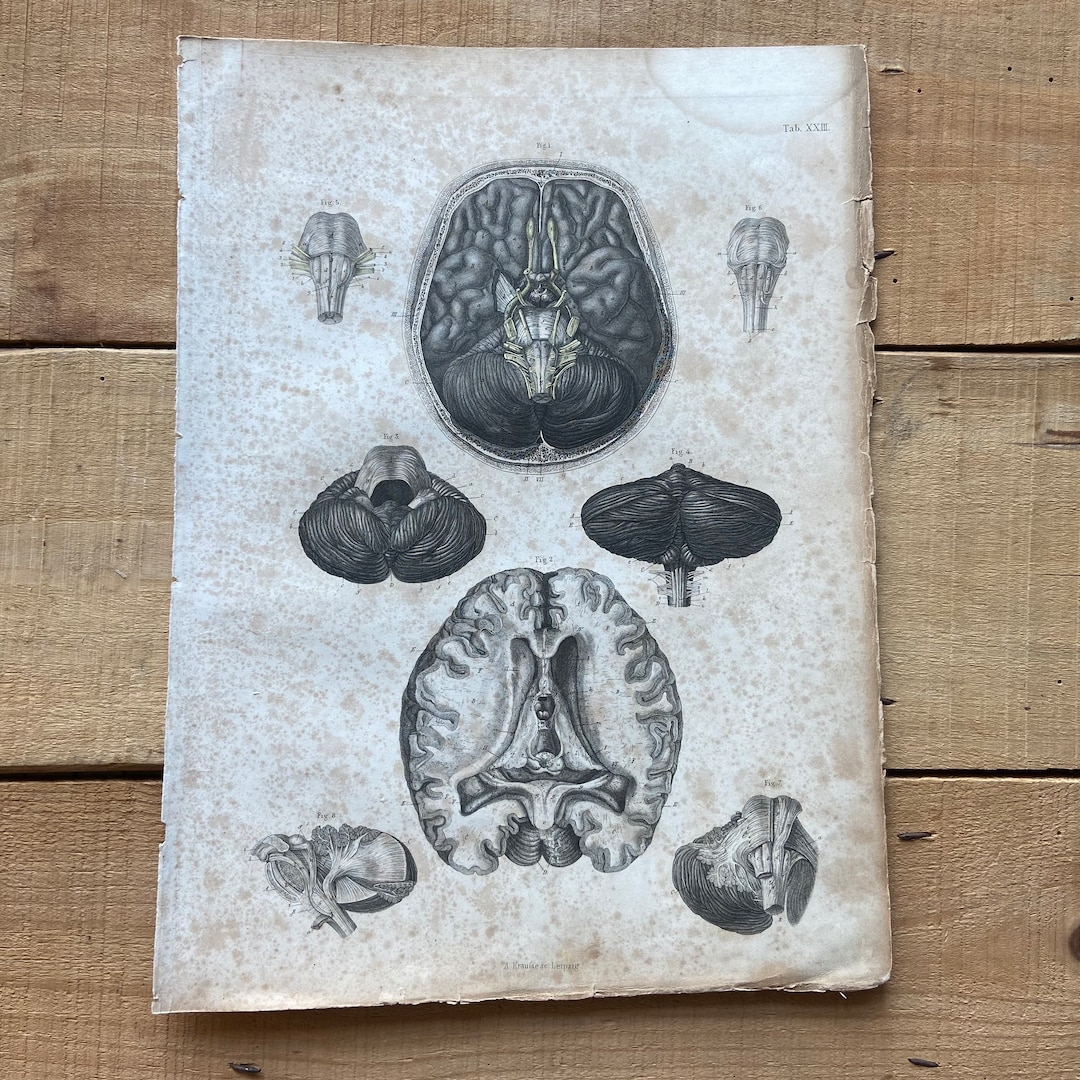 Anatomical Chart. Atlas of German Anatomy of 1860. Original. Very Rare ...