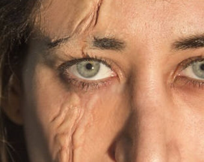 Silicone Prosthetic Scar C8 Platinum Silicone Gel With Cap Plastic ...