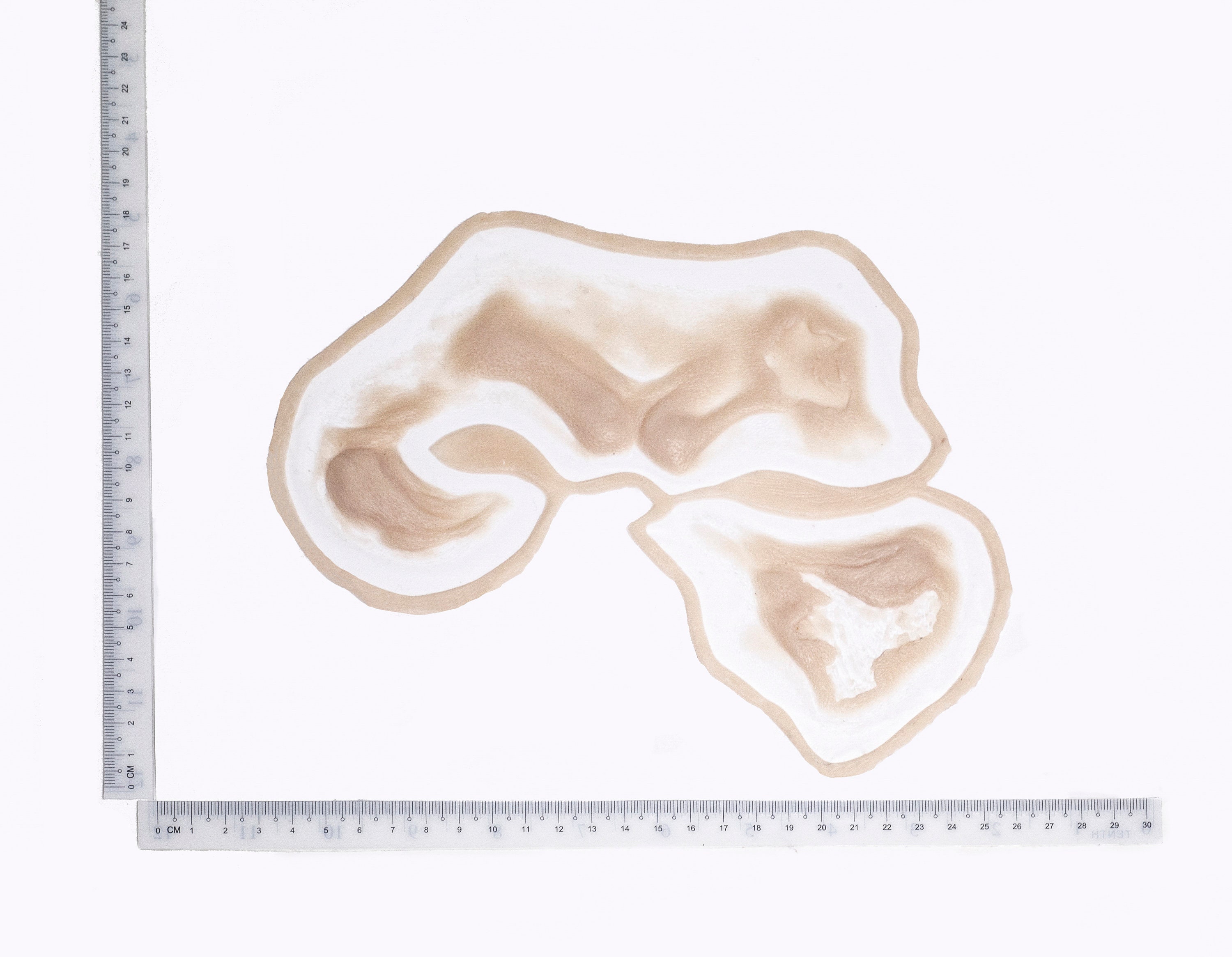 Silicone Prosthetics Forehead and Cheekbones Z14 - Platinum Silicone ...