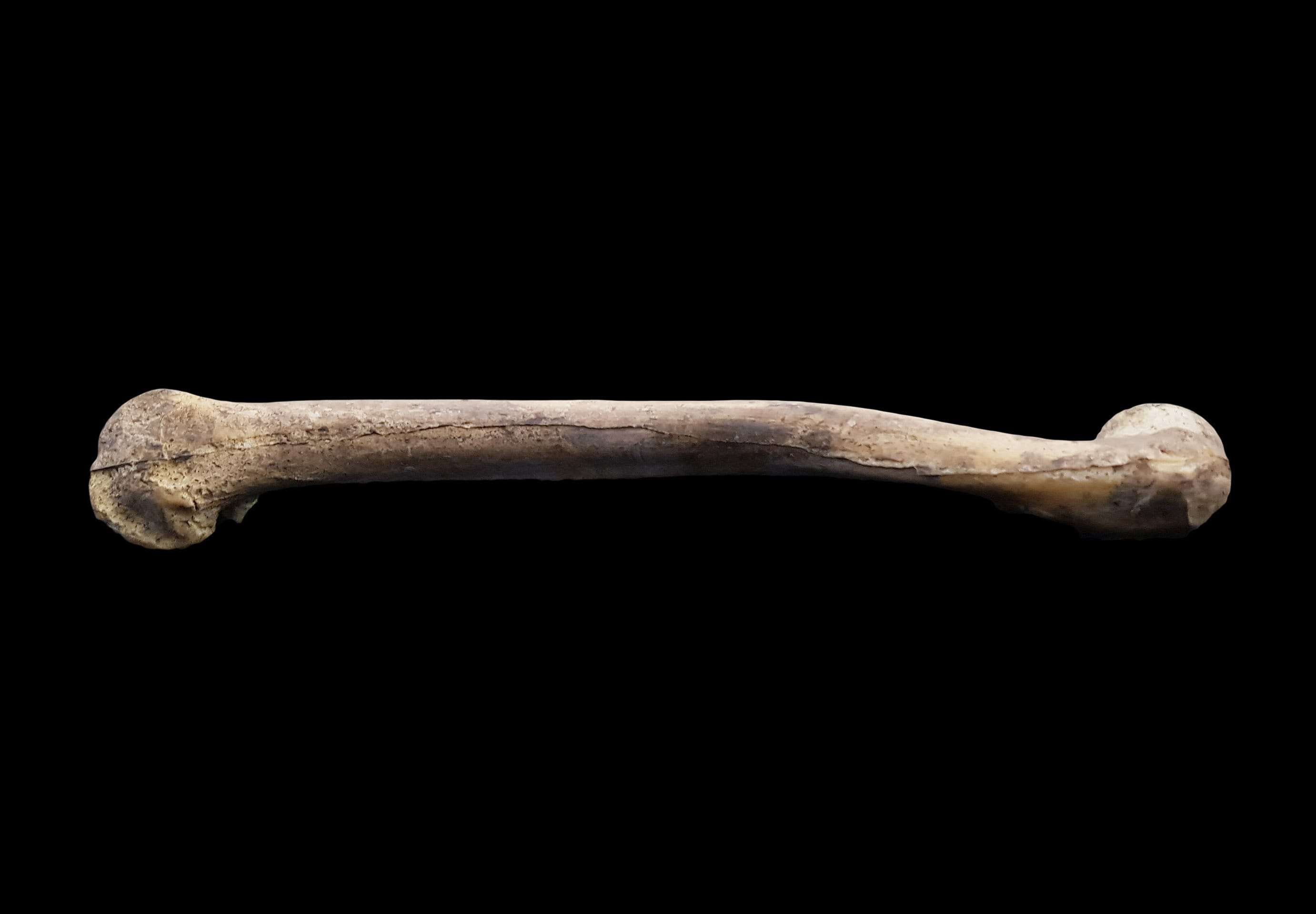 Human Femur Bone