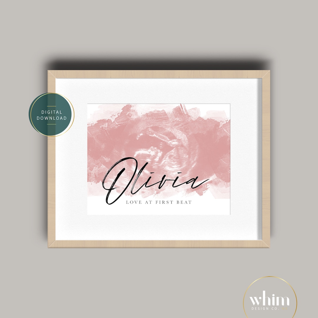 Ultrasound Print | Custom Birth Keepsake | Nursery Print | Watercolor ...
