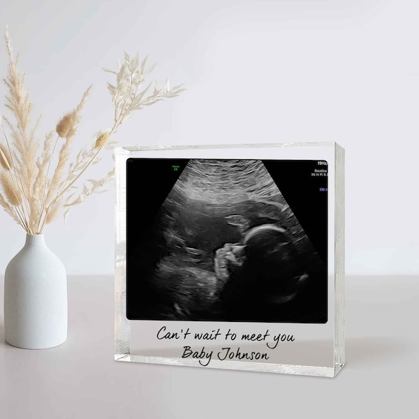 Ultrasound Gifts - 60+ Gift Ideas for 2024