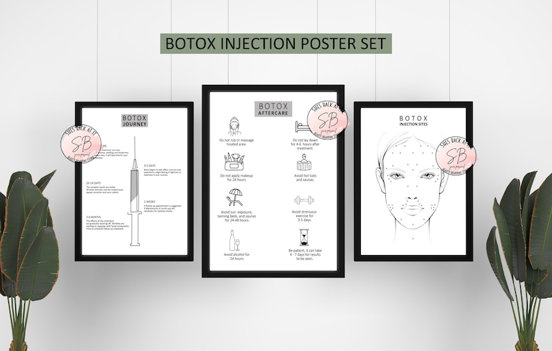 Botox Journey Poster Set of 3, Training Poster, Botox Injection Site ...