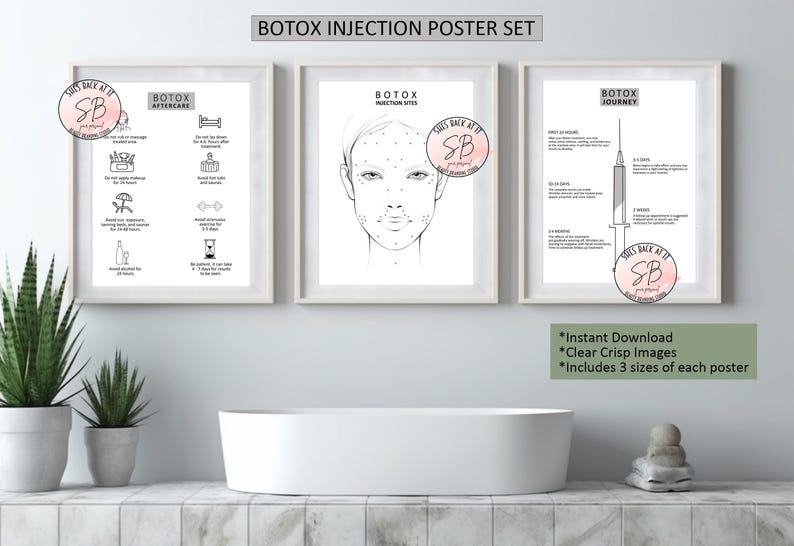 Botox Journey Poster Set of 3, Training Poster, Botox Injection Site ...
