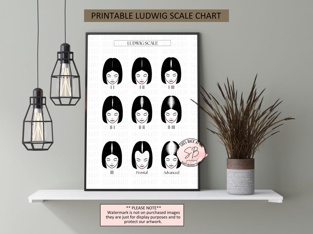 Hair Stylist Posters, Ludwig Scale Chart, Women's Hair Loss Stages ...