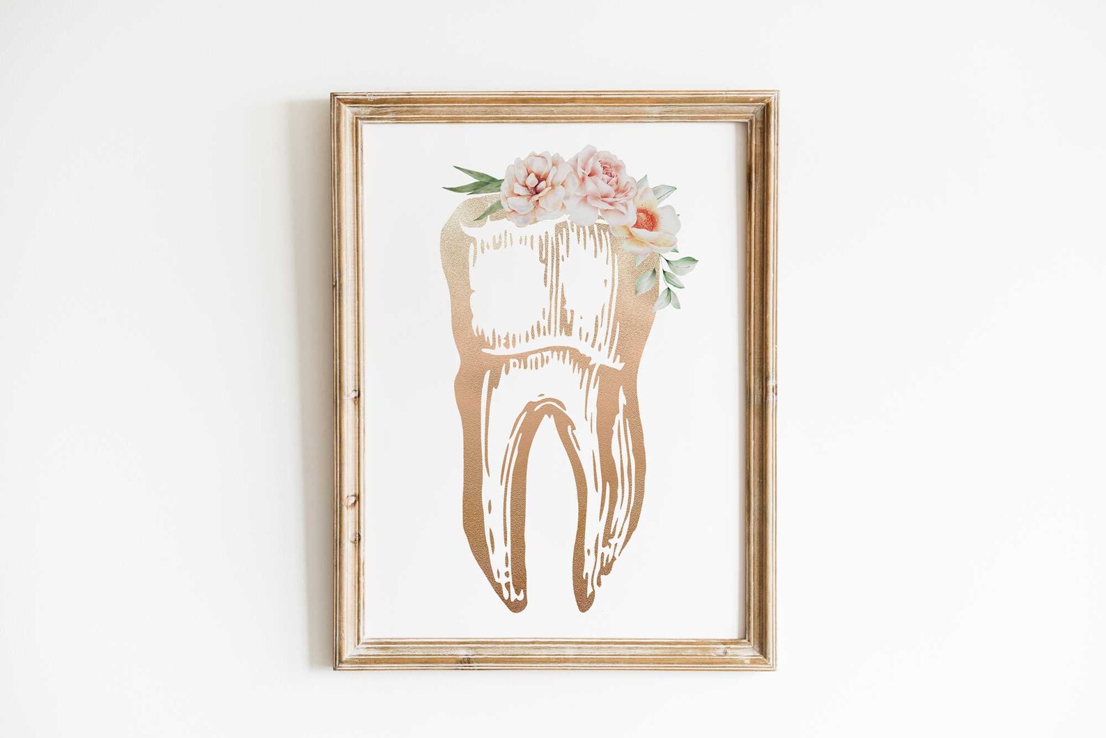 Dentist Office Decor Tooth Dental Art Print Floral Anatomy - Etsy
