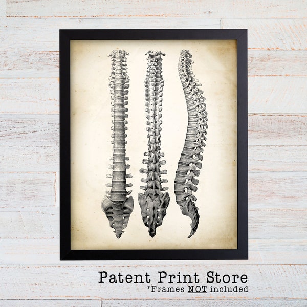 Human Spine Print Wall Art - Etsy