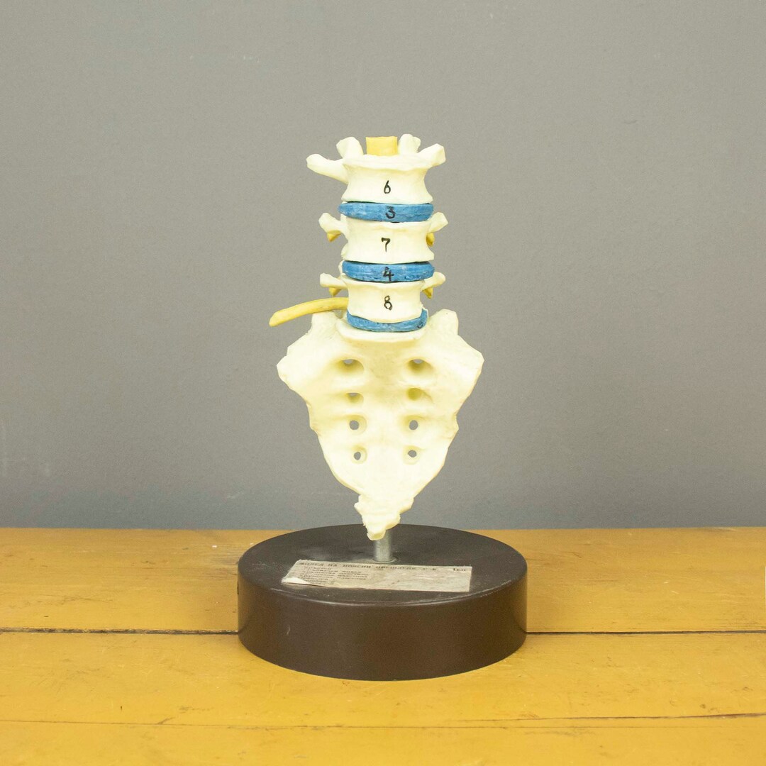 Vintage Anatomical Model of the Human's Lower Back Vertebrae and Sacral ...