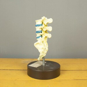 Vintage Anatomical Model of the Human's Lower Back Vertebrae and Sacral ...