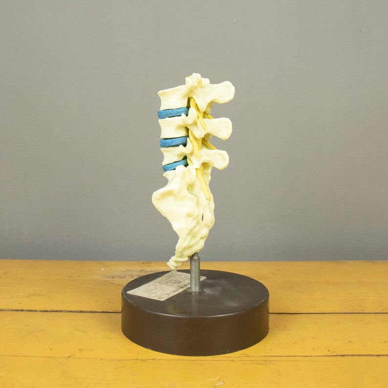Vintage Anatomical Model of the Human's Lower Back - Etsy