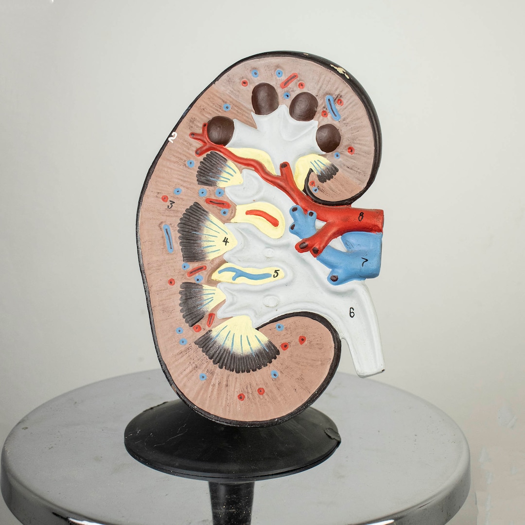 Vintage Anatomical Model of the Human Kidney - Etsy