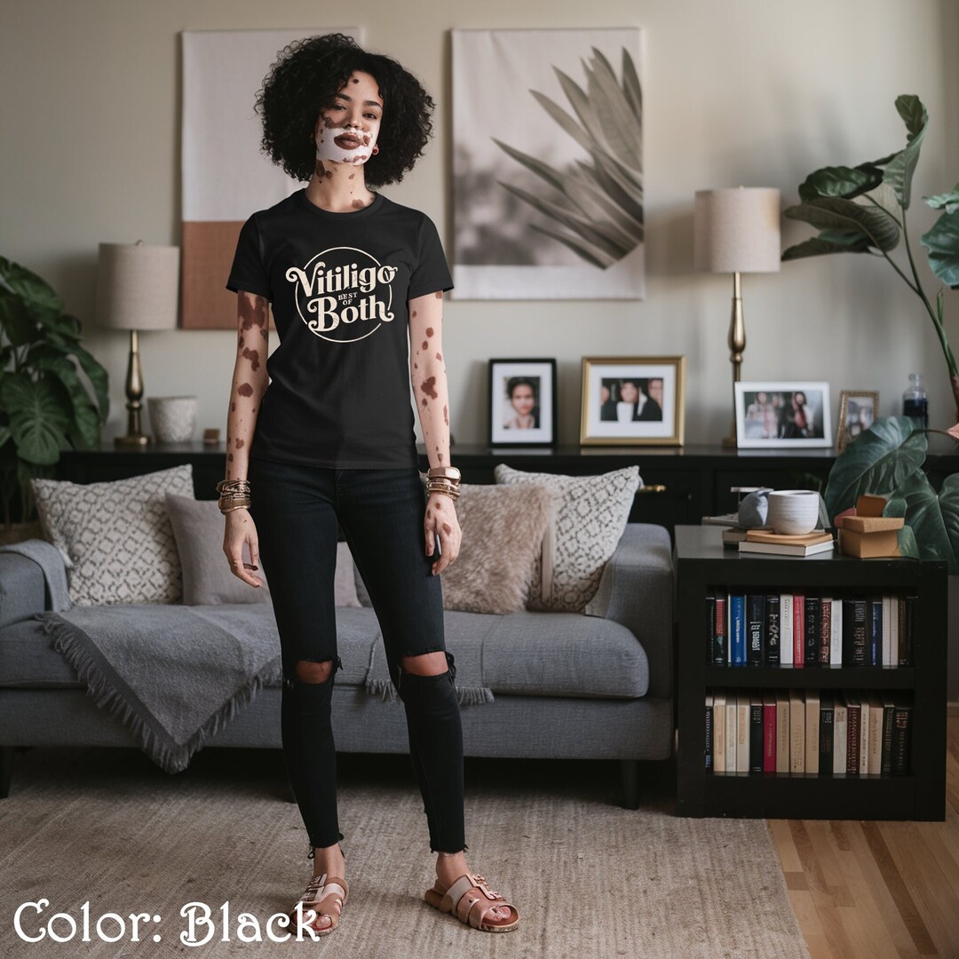 T Shirt Cool Vitiligo Best of Both Unisex T-shirt Vitiligo Design Soft ...