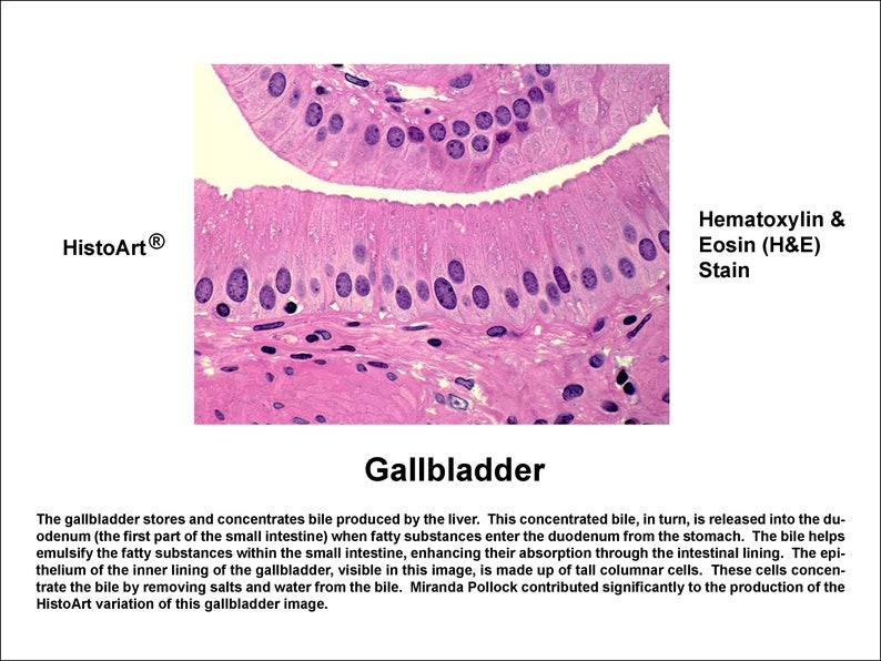 Gallbladder Unframed - Etsy