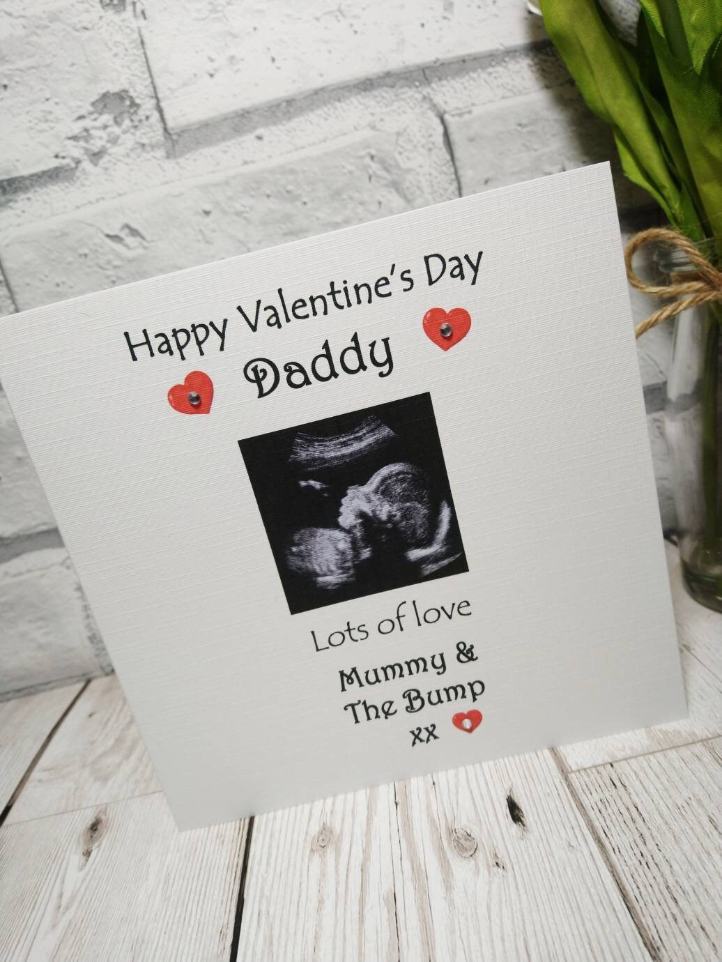 Baby scan card greeting card from the bump Valentine's | Etsy