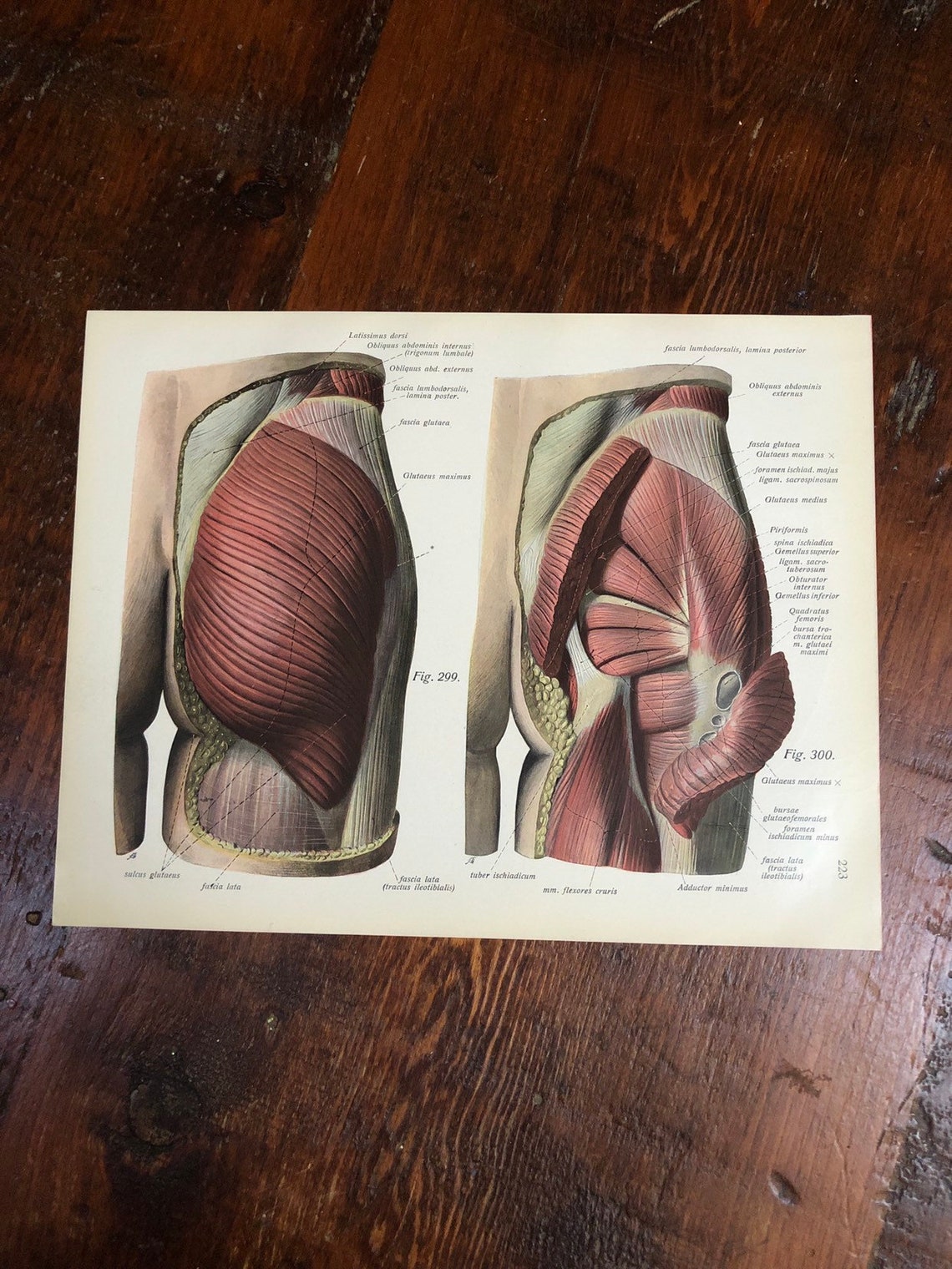 LOT OF 2 Male Abdominal Muscle Anatomy Prints Genuine 1922 - Etsy