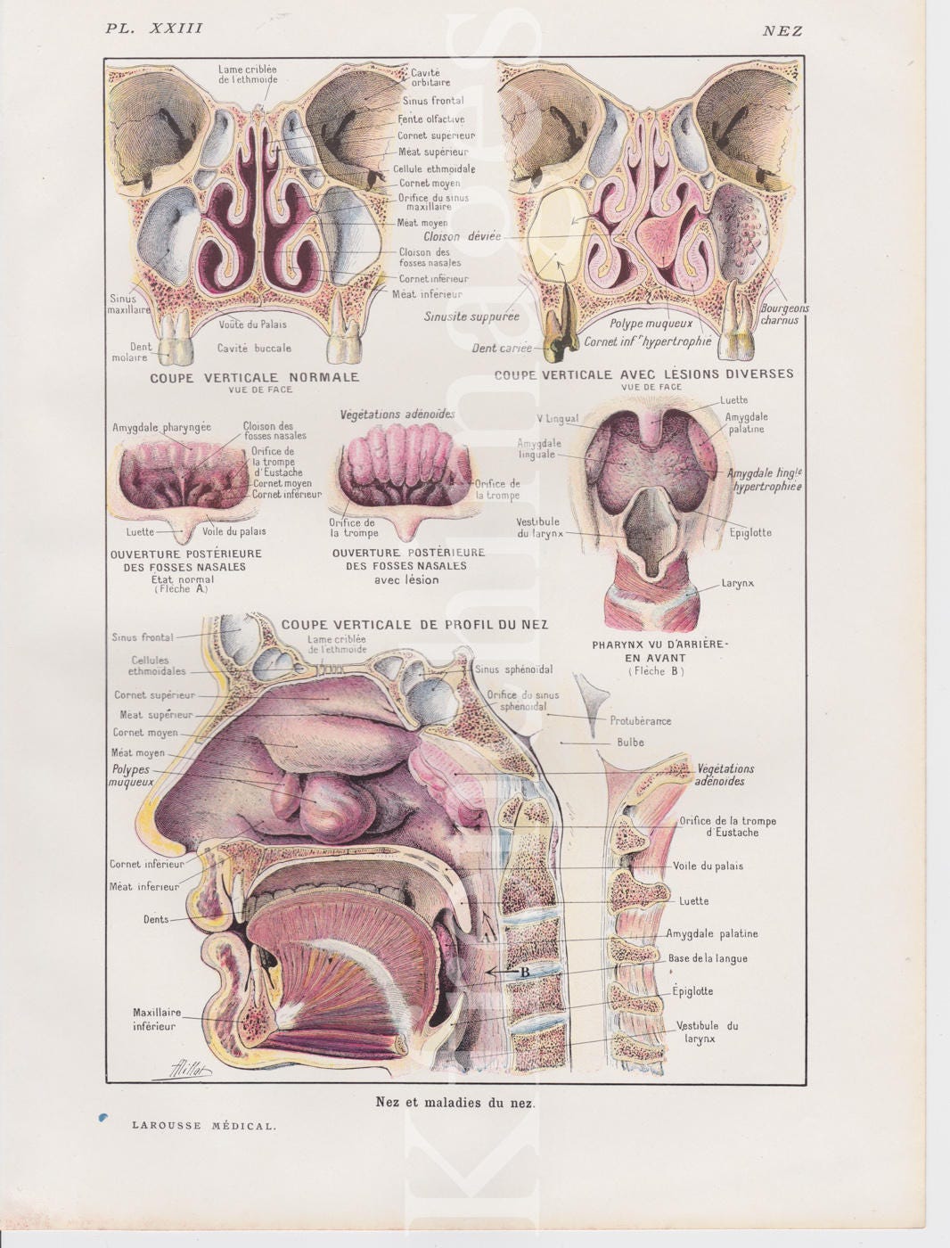Neus sinus hoofd anatomie plaat Franse vintage originele print jaren ...