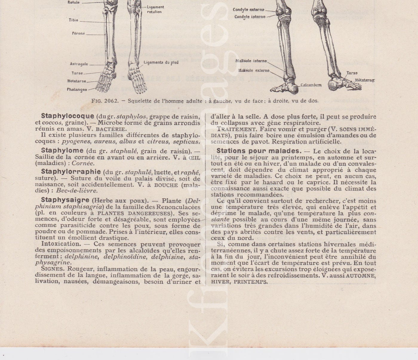 Skeleton Anatomy Plate French Vintage Original Print Medical - Etsy