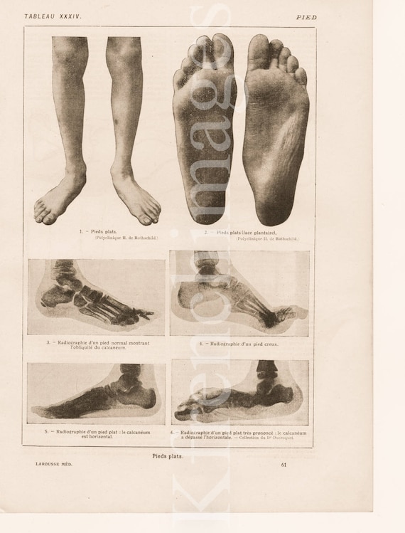 Feet Foot Anatomy Plate French Vintage Original Print 1920s | Etsy