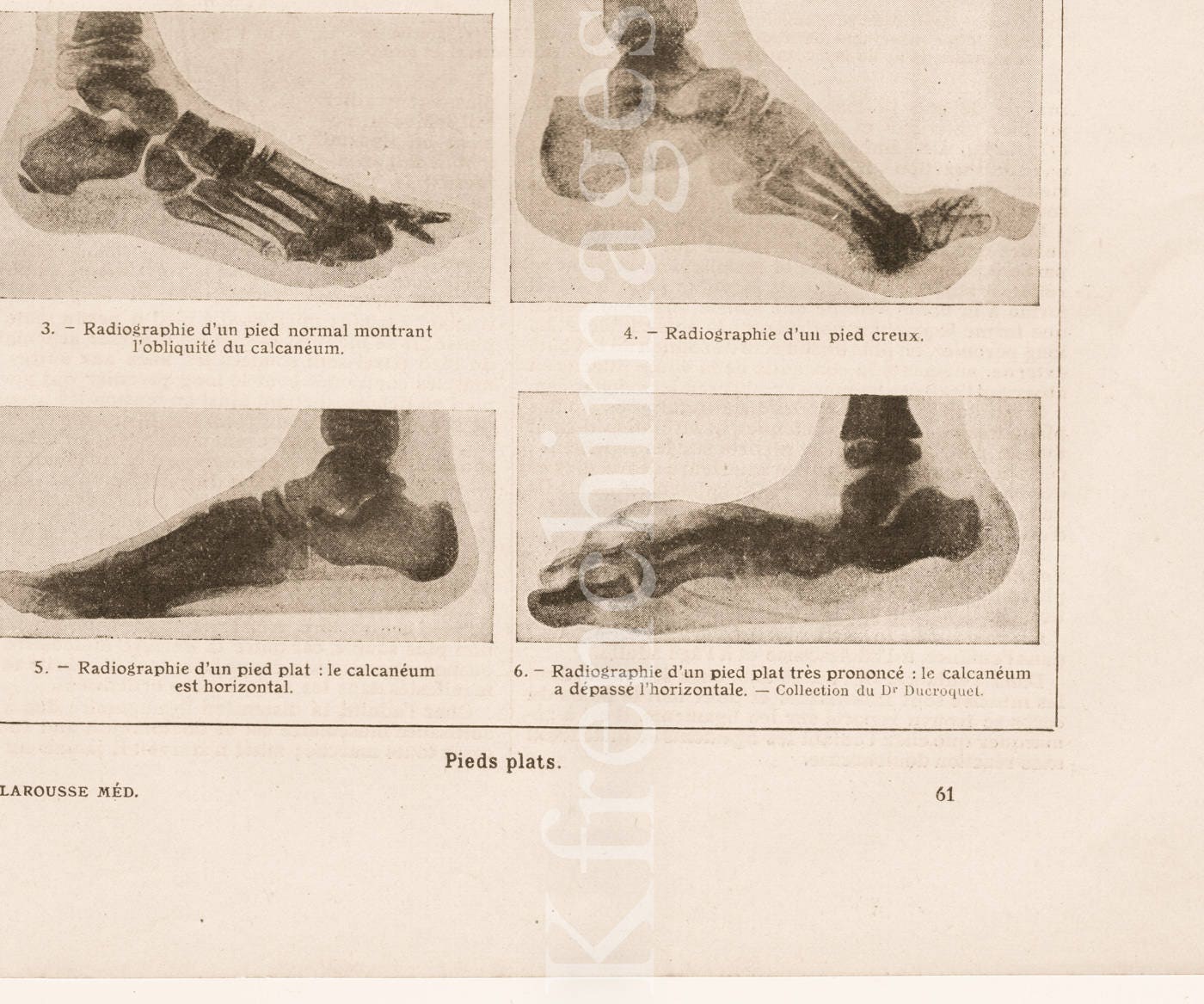 Vintage Foot Anatomy Print, French Medical Illustration, 1920s - Etsy