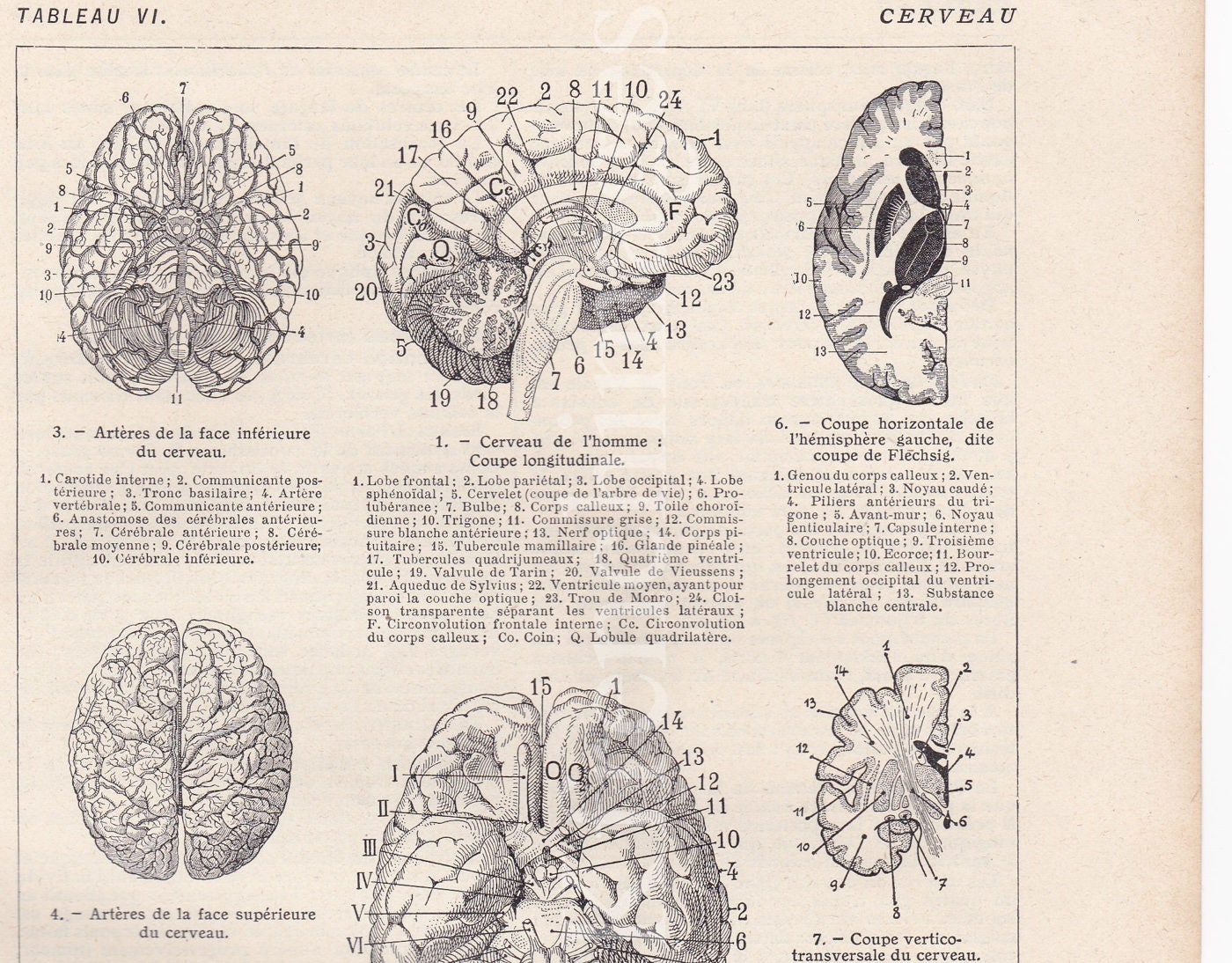 Brain Anatomy Plate French Vintage Original Print Medical or Curiosity ...