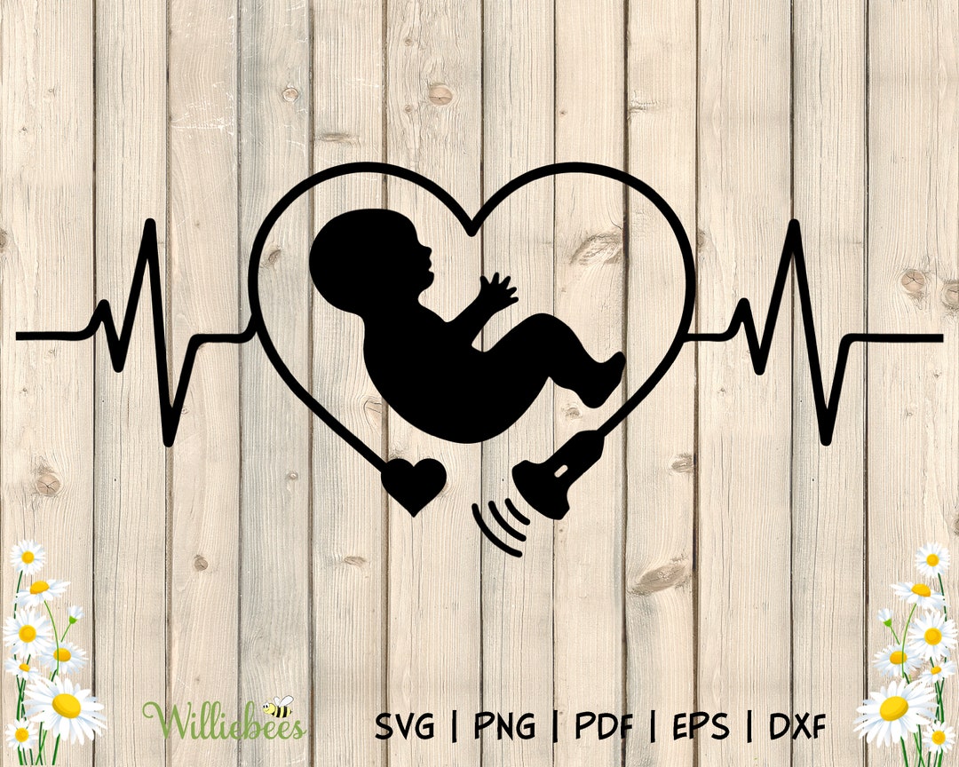 Baby Ultrasound Sonogram SVG, Pregnancy and Fertility, Fetus Design ...