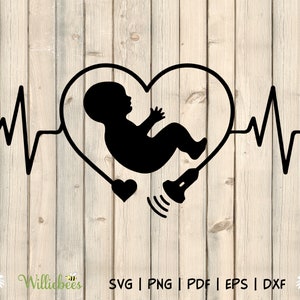 Baby Ultrasound Sonogram SVG, Pregnancy and Fertility, Fetus Design ...
