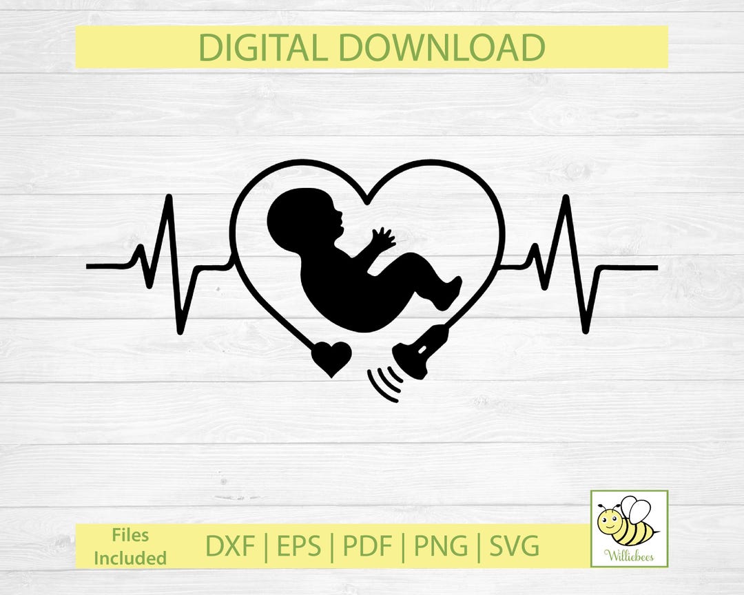 Baby Ultrasound Sonogram SVG, Pregnancy and Fertility, Fetus Design ...