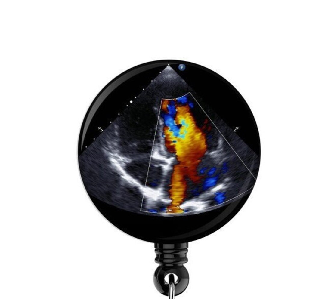 ECHO Blood Flow Retractable Badge Reel Vascular Cardiac Sonographer ...
