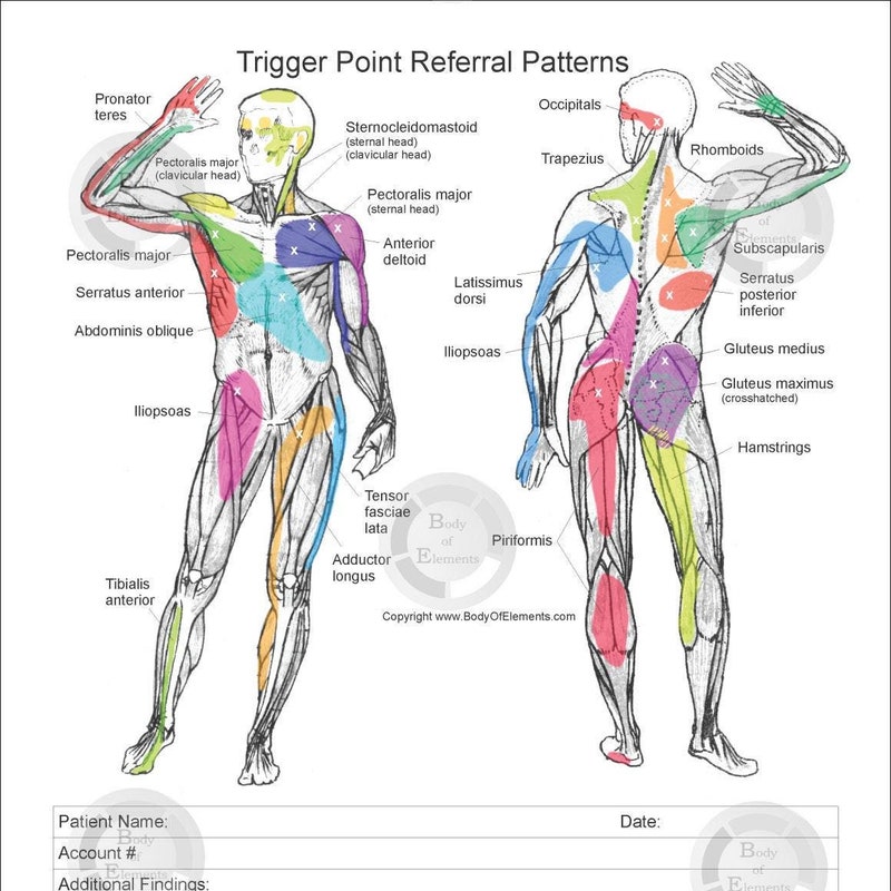 Muscle Trigger Point Chart - Etsy