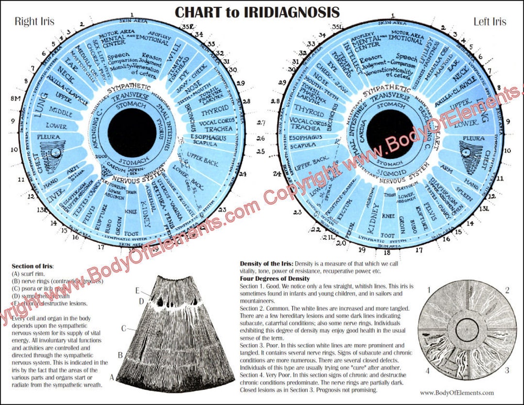 Iridiagnosis Iridology Eye Chart - 8.5 " X 11" Digital Download ...