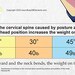Text Neck Syndrome Poster Anterior Head Carriage Position Chiropractic ...