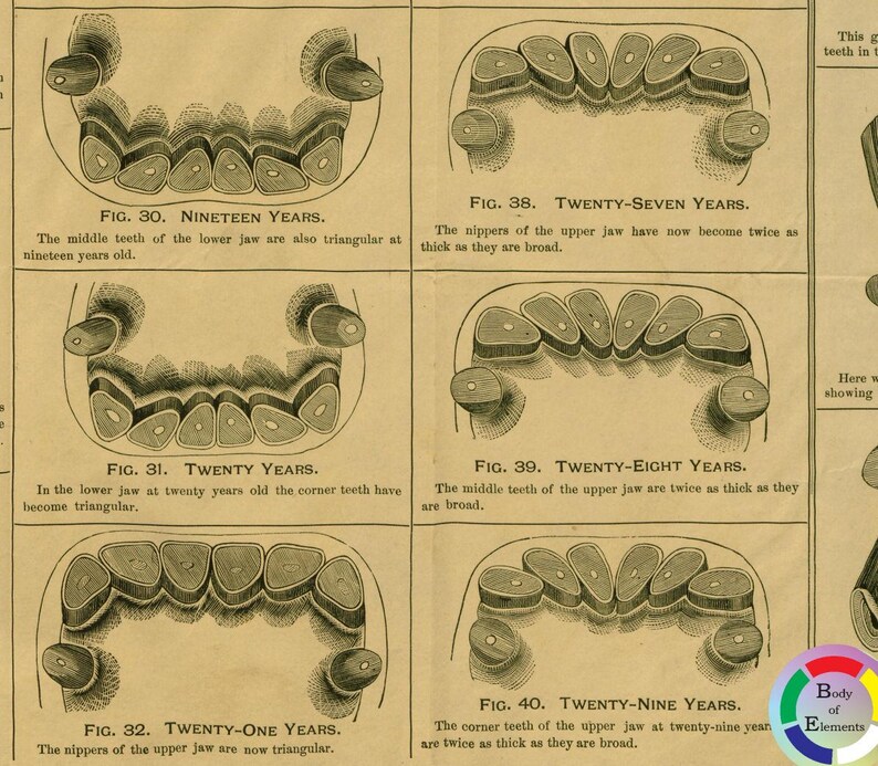Equine Age of Horse by Teeth Poster Veterinary Dental Anatomical Chart ...