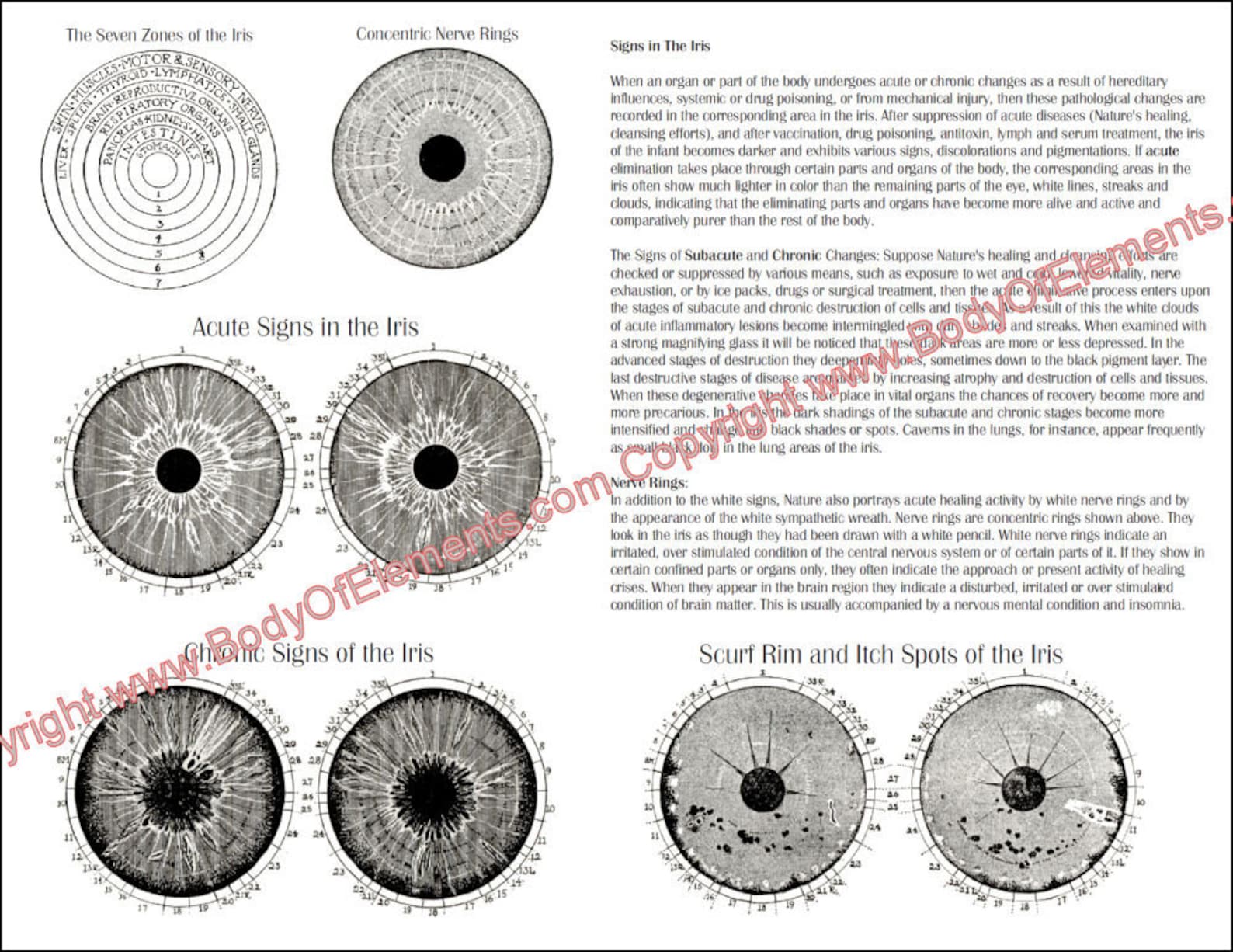 Iridiagnosis Iridology Eye Chart - 8.5 " X 11" Digital Download ...