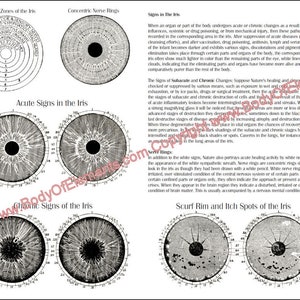 Iridiagnosis Iridology Eye Chart - 8.5 " X 11" Digital Download ...