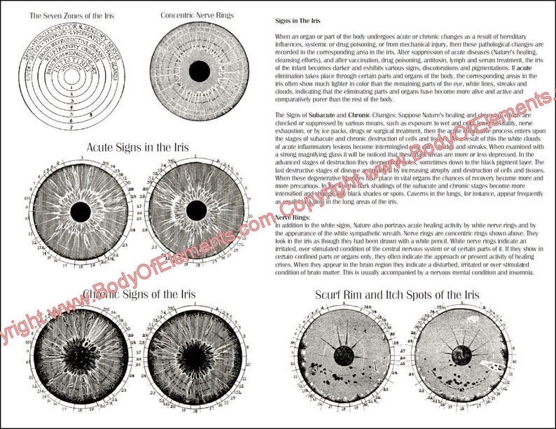 Iridiagnosis Iridology Eye Chart - 8.5 " X 11" Digital Download ...