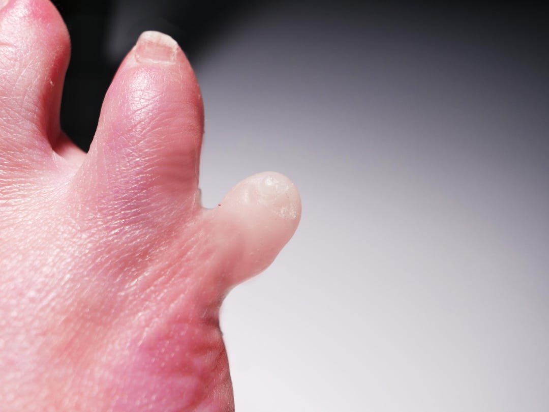 Silicone Little Toe Prosthetic – Realistic SFX for Halloween & Film ...