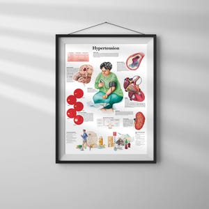 Hypertension Chart Anatomy Human Physiology Charts Medical Student Wall ...