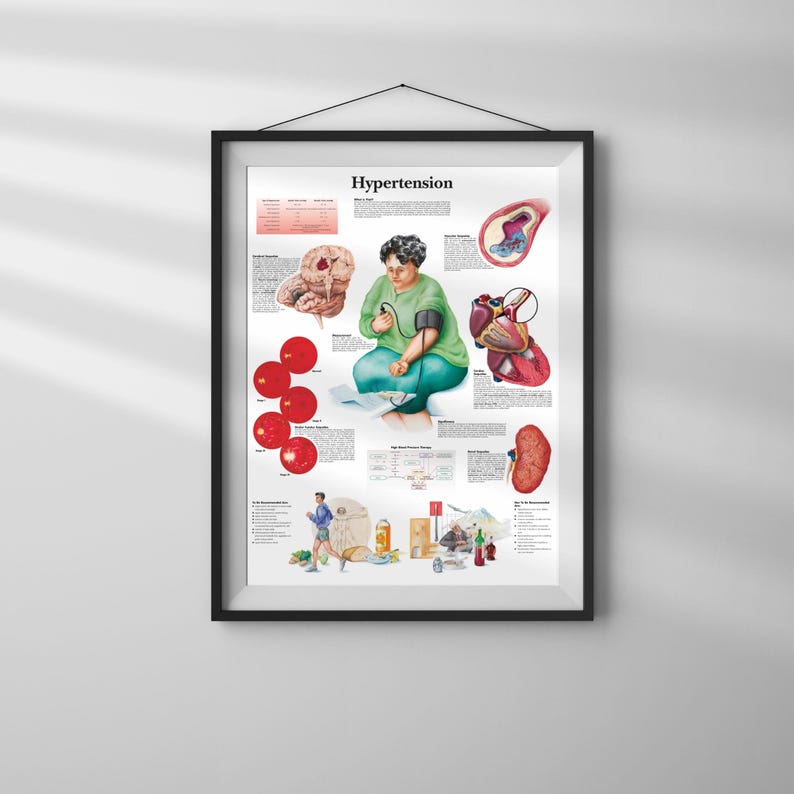 Hypertension Chart Anatomy Human Physiology Charts Medical Student Wall ...