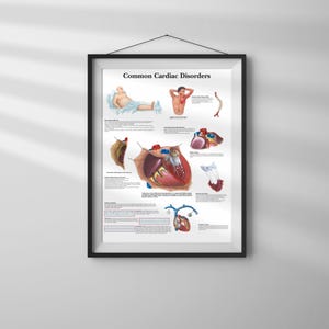 Common Cardiac Disorders Chart Anatomy Human Physiology Charts Medical ...