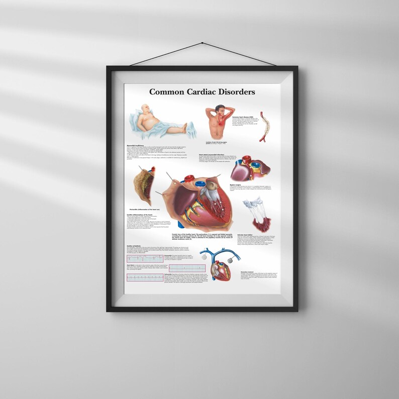 Common Cardiac Disorders Chart Anatomy Human Physiology Charts Medical ...