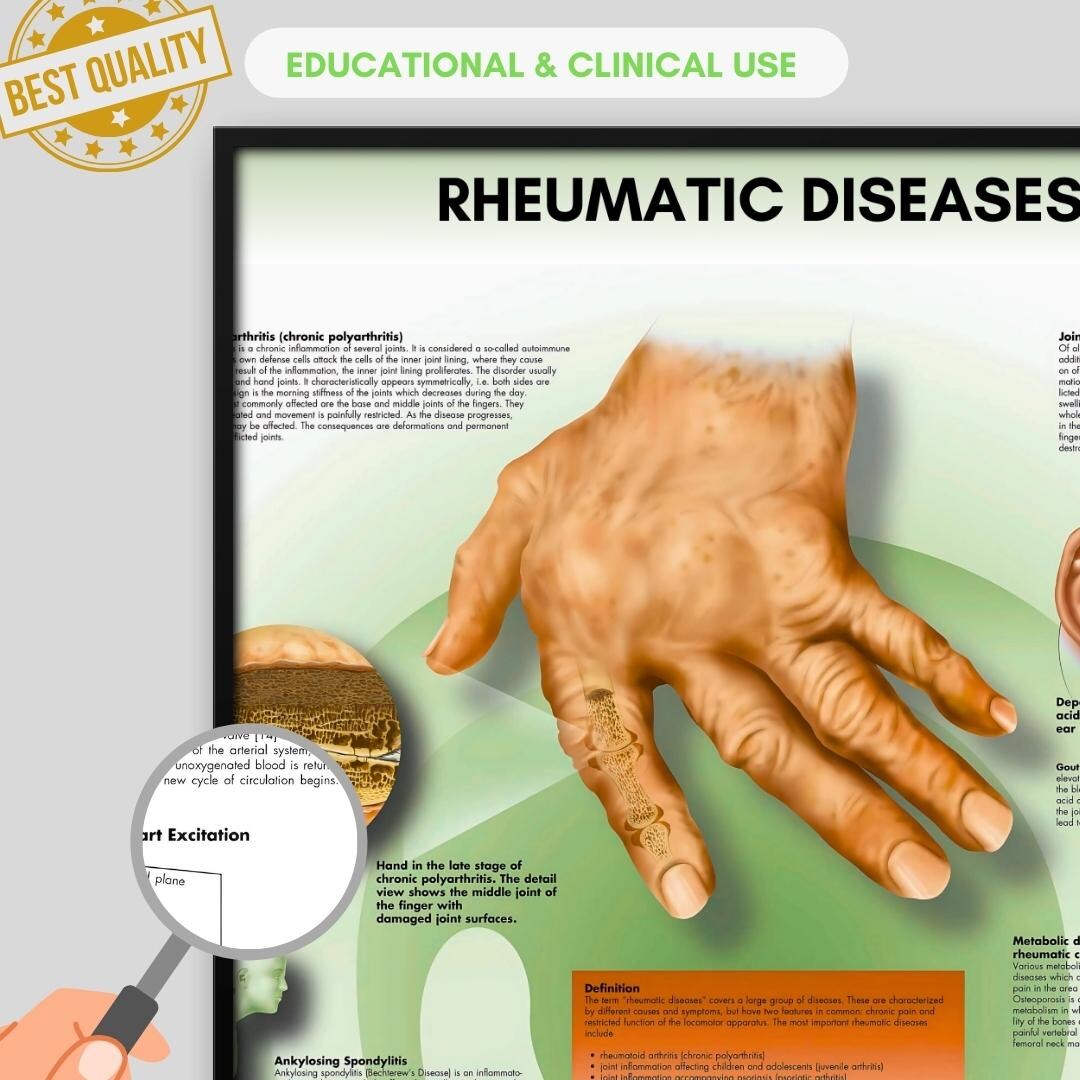 Rheumatic Diseases Poster Anatomy Human Biology Poster Medical Student ...