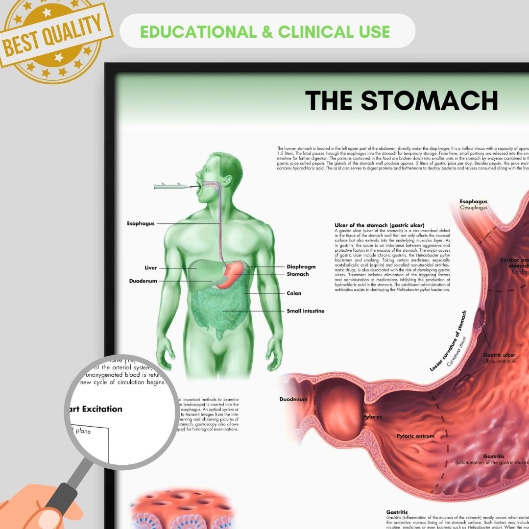 Stomach Poster Anatomy Human Biology Poster Medical Student Poster ...
